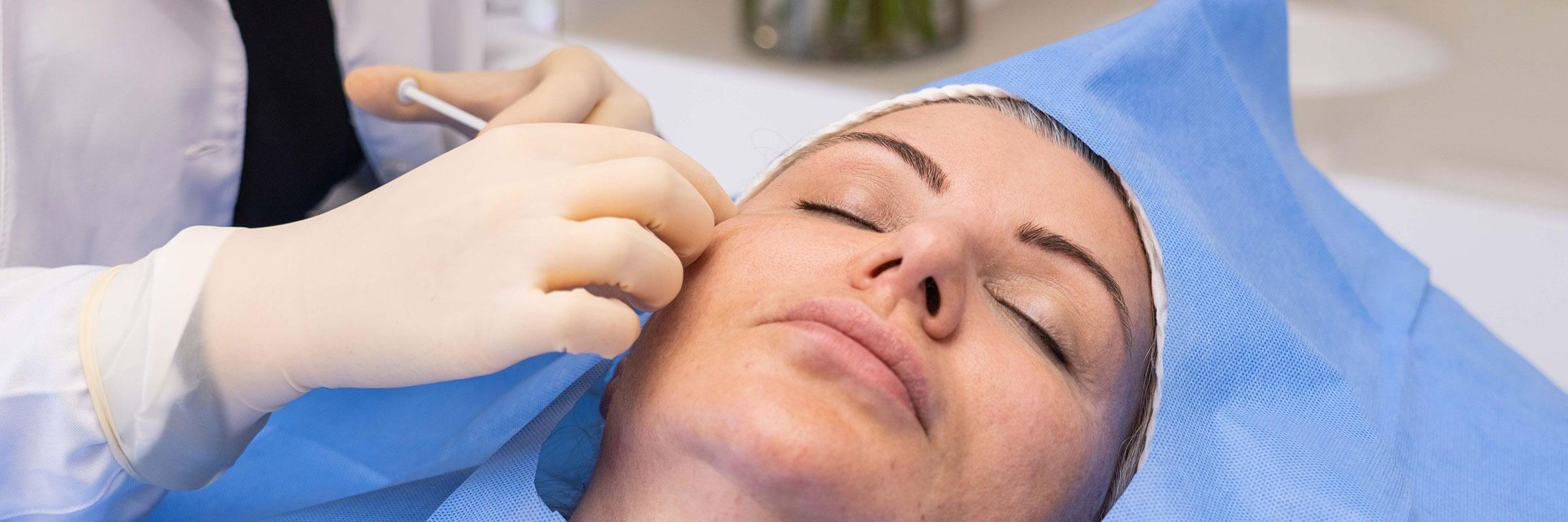 Thread Lift innovative face and body contouring treatment